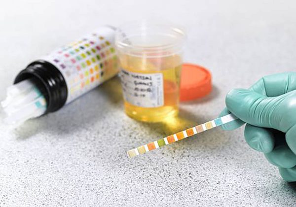 ICPO cops undergo ‘surprise’ drug test