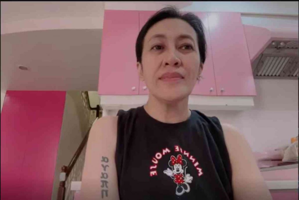 Ai-Ai warns netizens vs psoriasis treatment ad Ai-Ai warns netizens vs psoriasis treatment ad