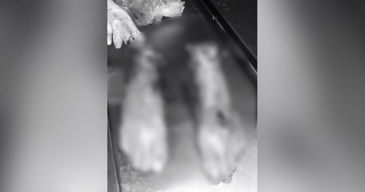 Severed feet left at Bacolod gas station