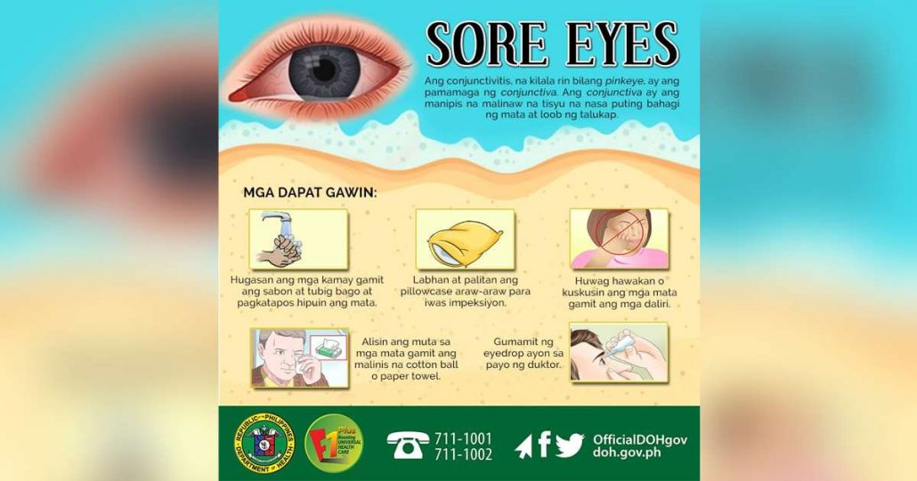 City Health Office urges safety vs sore eyes