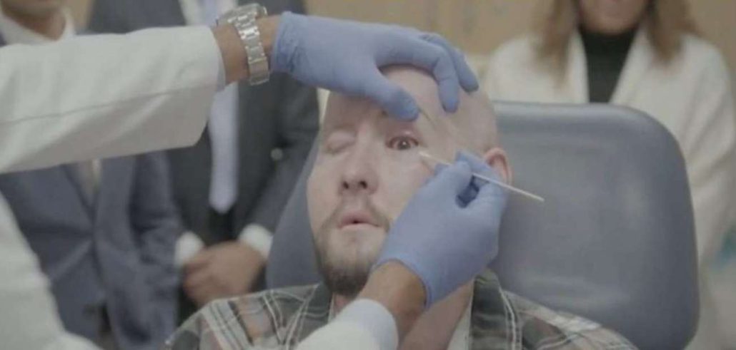 World’s first complete eye transplant