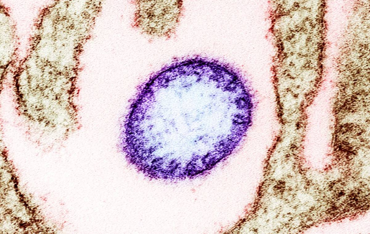 Bacolod CHO urged to strengthen Nipah virus preparedness with DOH